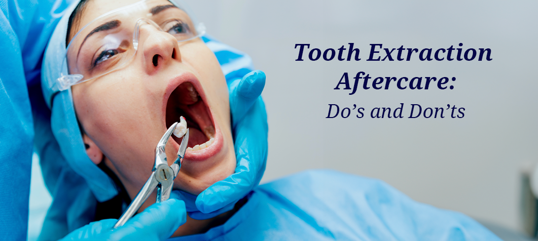 Tooth Extraction Aftercare: Essential Do’s & Don’ts for Fast Healing
